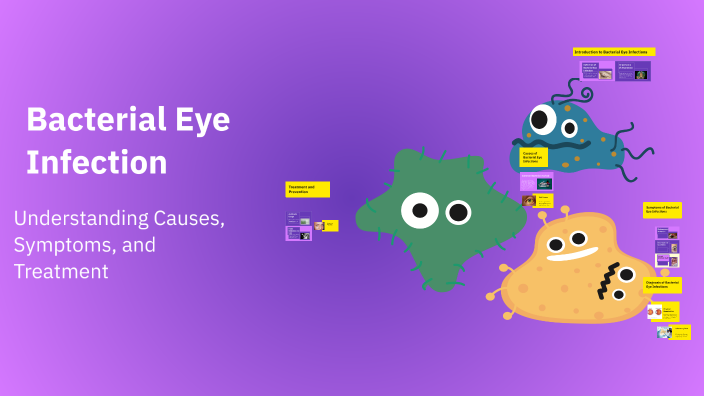 Bacterial Eye Infection by Safa Khalil on Prezi