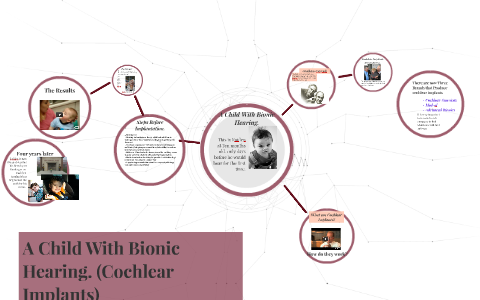 A Child With Bionic Ears. by Crystal Parvu on Prezi