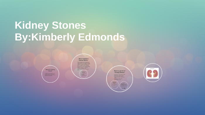 Kidney Stones by Kimberly Edmonds