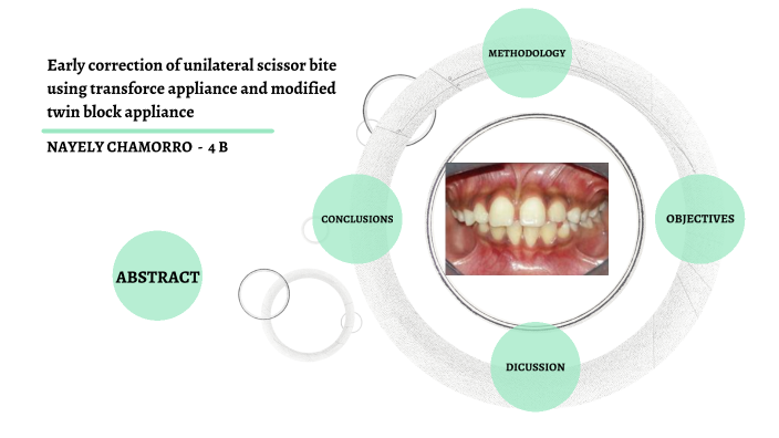 Early Correction Of Unilateral Scissor Bite Using Transforce Appliance