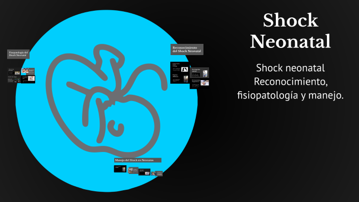 Shock Neonatal by Edgar Trigueros on Prezi