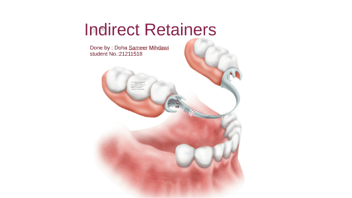 It is a component of a tooth mucosa borne RPD, by Du Mi on Prezi