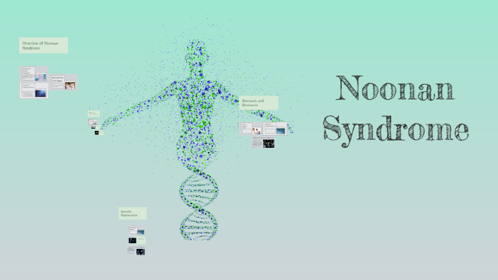 Noonan Syndrome by Connor Hart on Prezi