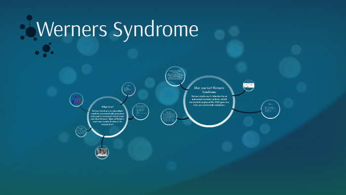 Werners Syndrome by Harper Gibbons on Prezi