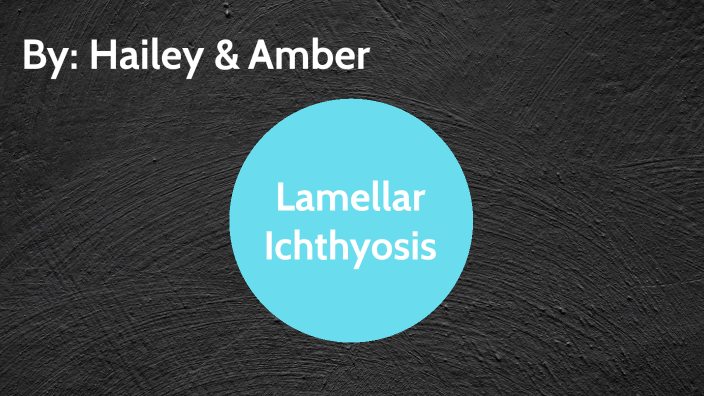 skin disease project by amber howell on Prezi