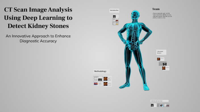 CT Scan Image Analysis Using Deep Learning to Detect Kidney Stones by ...