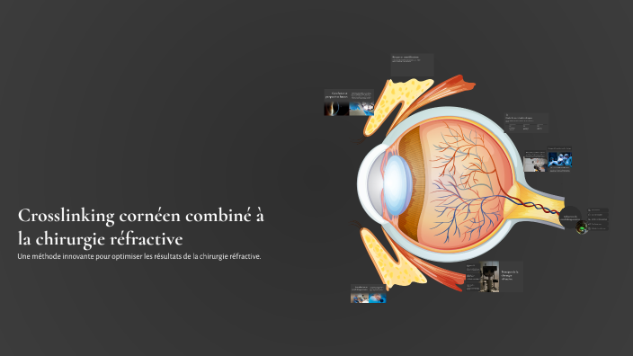 Crosslinking cornéen combiné à la chirurgie réfractive by Miral ...