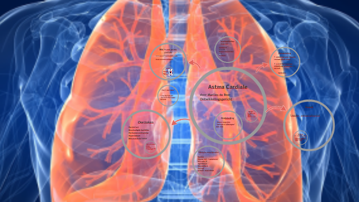 Asthma Cardiale by Marlies de Boer on Prezi