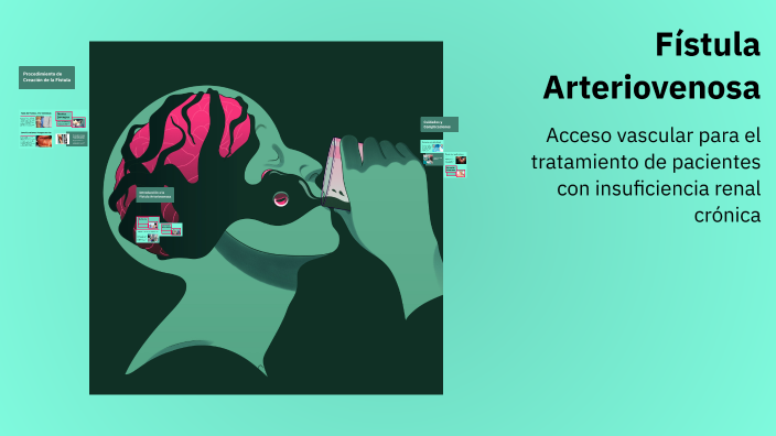 Fístula Arteriovenosa by omar rivadeneyra on Prezi