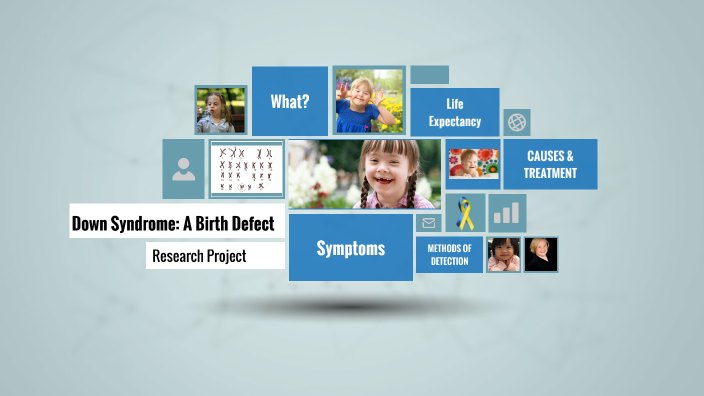 Down Syndrome Research by Alivia James on Prezi