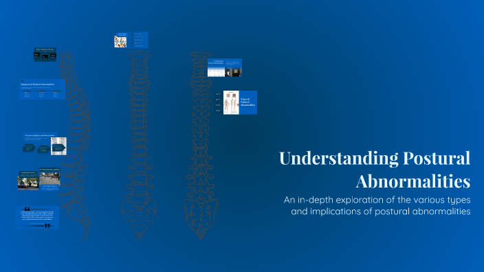 Understanding Postural Abnormalities by mohamed diwan on Prezi