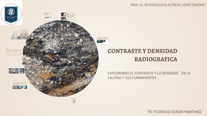 Contrast and Radiological Density by Federico Duran Martinez on Prezi