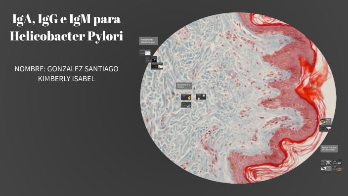 IgA, IgG e IgM para Helicobacter Pylori by Isabel Santiago on Prezi