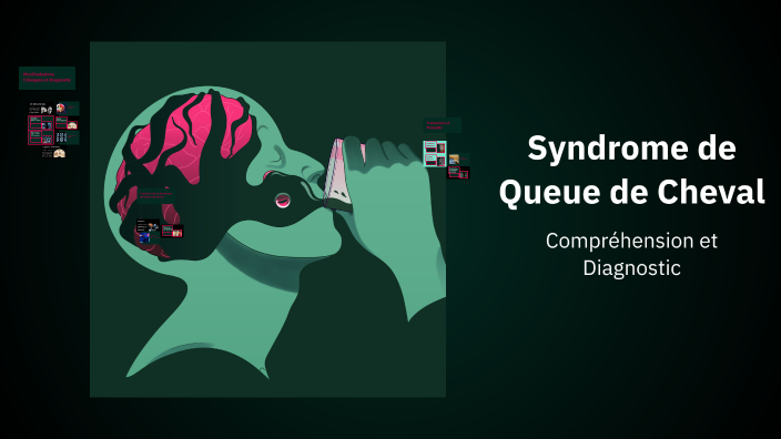 Syndrome de Queue de Cheval by Study WithUs on Prezi