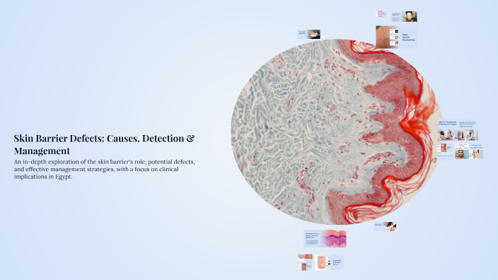 Skin Barrier Defects: Causes, Detection & Management by Ahmad El-Shiekh ...