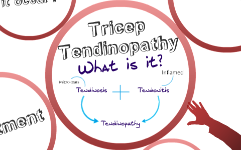 Tricep Tendinopathy by Charlie Luscombe on Prezi