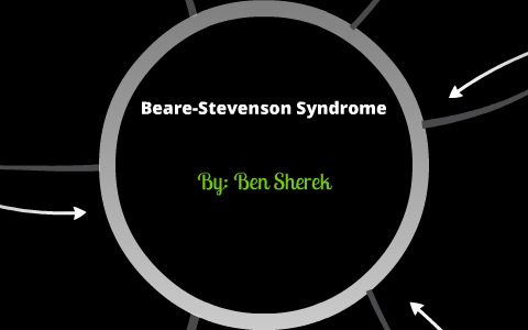 Beare-Stevenson Syndrome by Ben Sherek on Prezi