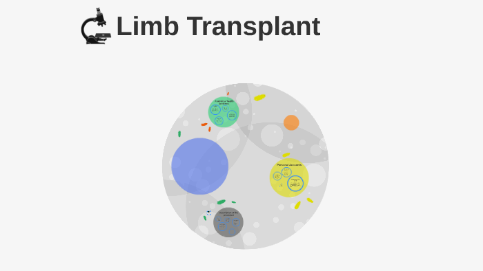 Limb Transplant by Tina Prentis