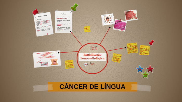 CÂNCER DE lÍNGUA by TASSYA LIMA on Prezi