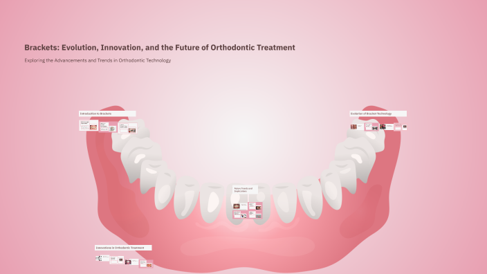 Brackets: Evolution, Innovation, and the Future of Orthodontic ...