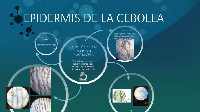 EPIDERMIS DE LA CEBOLLA by Mubieri Sandoval Varela on Prezi