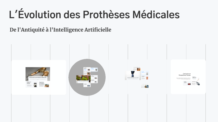 L'Évolution des Prothèses Médicales by Hasna WAJDANE on Prezi