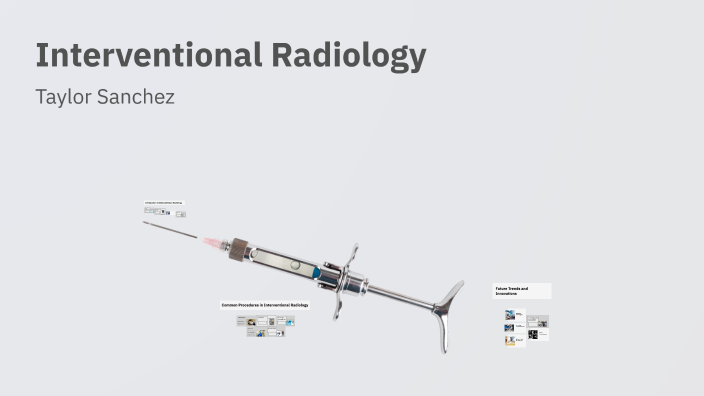 Interventional Radiology by Taylor Sanchez on Prezi