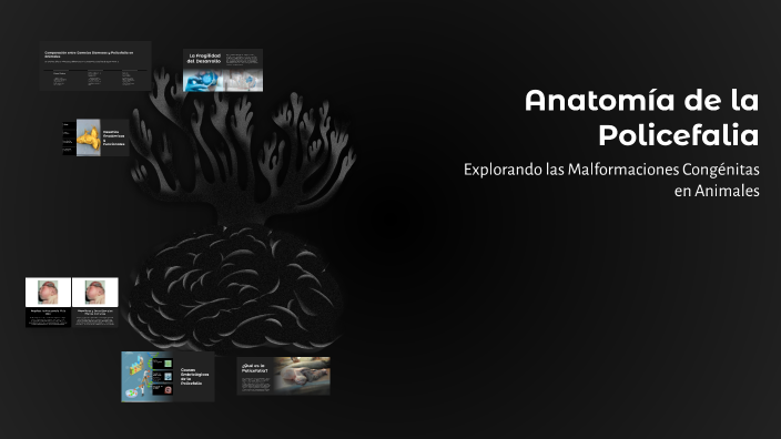Anatomía de la Policefalia by Santiago Morán moreno on Prezi