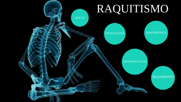 TRABAJO ANATOMÍA RAQUITISMO by Francisco Cazorla Ayala on Prezi