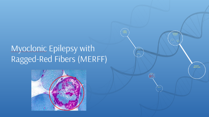 MERFF by Elizabeth Yim on Prezi