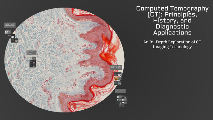 Computed Tomography (CT): Principles, History, and Diagnostic ...