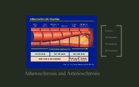 Atherosclerosis and Arteriosclerosis by Candace Otten on Prezi