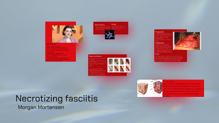 One pager Necrotizing fasciitis by Morgan Mortensen on Prezi