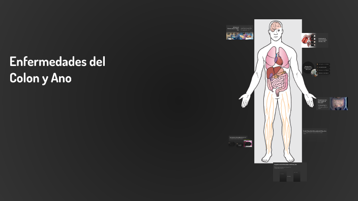 Enfermedades del Colon y Ano by Carolina Naula on Prezi