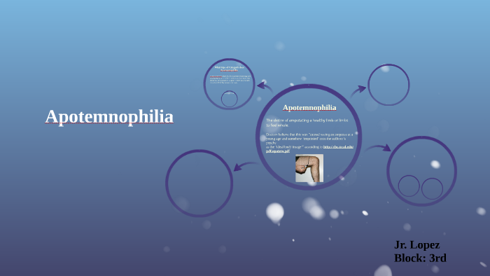 Apotemnophilia by Apolinar Lopez on Prezi