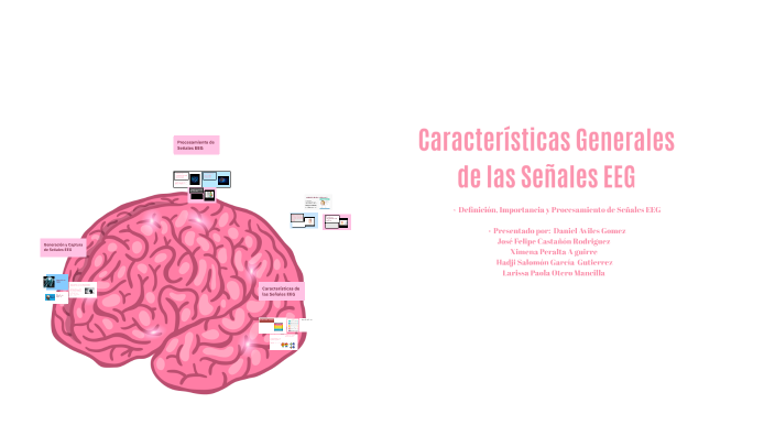 Características Generales de las Señales EEG by Larissa Otero on Prezi