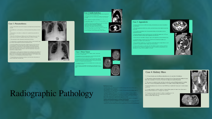 Radiographic Pathology by Paige Hilde on Prezi