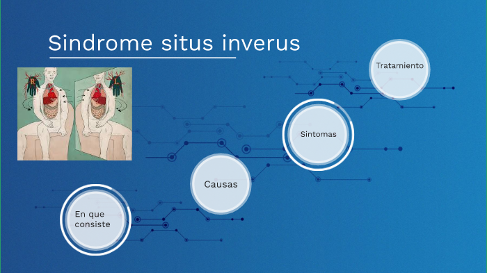 síndrome situs inversus by daniel gonzalez on Prezi