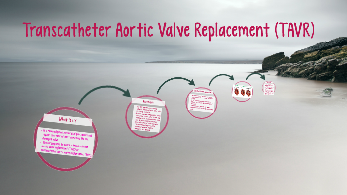 Transcatheter Aortic Valve Replacement (TAVR) by Haley Roberts on Prezi