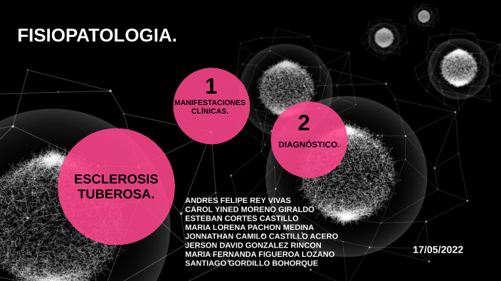 esclerosis tuberosa by david Gonsalez on Prezi