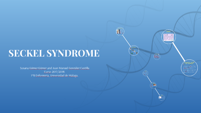 SECKEL SYNDROME by susana gmz on Prezi