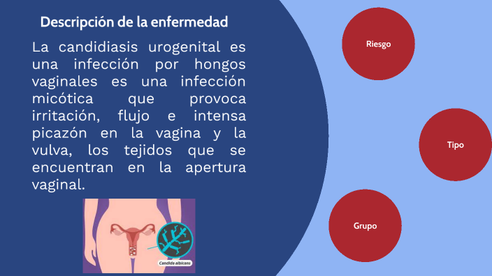 candidiasis by Andrea Yoselin Brito Alonso on Prezi