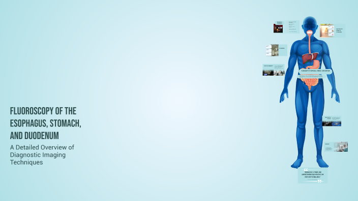 Fluoroscopy of the Esophagus, Stomach, and Duodenum by Taniya N on Prezi
