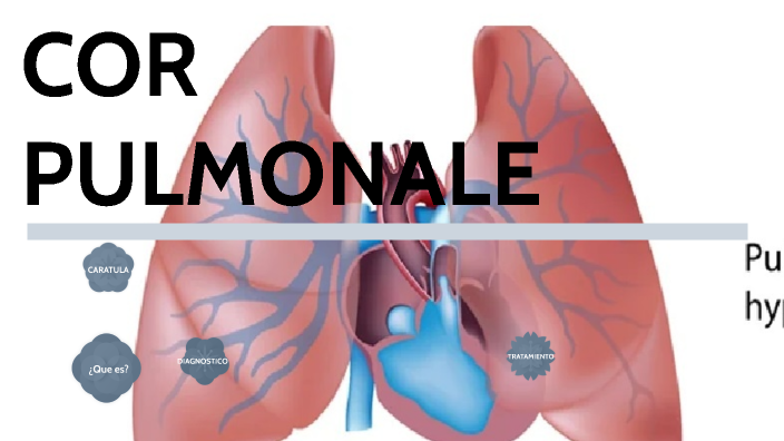 Cor pulmonale by Samuel DeJesus Aleman Garcia on Prezi