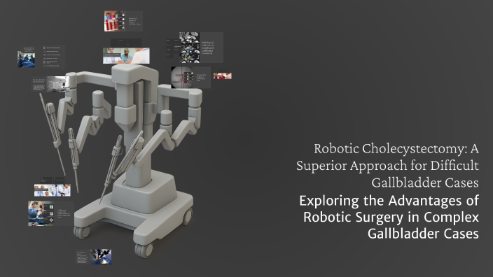 Robotic Cholecystectomy: A Superior Approach for Difficult Gallbladder ...