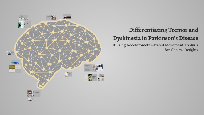 Differentiating Tremor and Dyskinesia in Parkinson’s Disease by Sandra ...