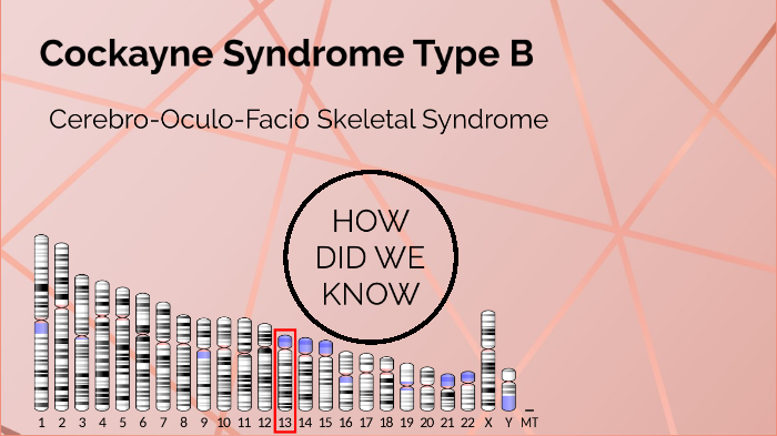 cockayne syndrome by maggie neal on Prezi