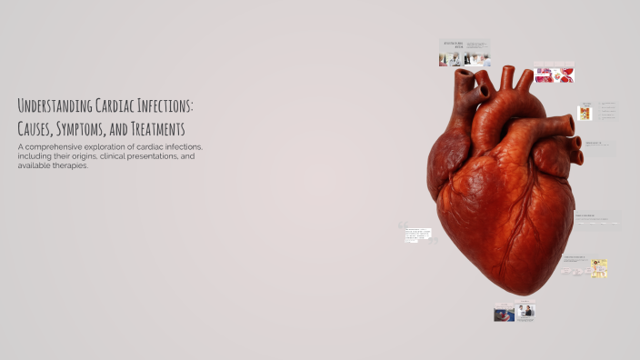 Understanding Cardiac Infections: Causes, Symptoms, and Treatments by ...
