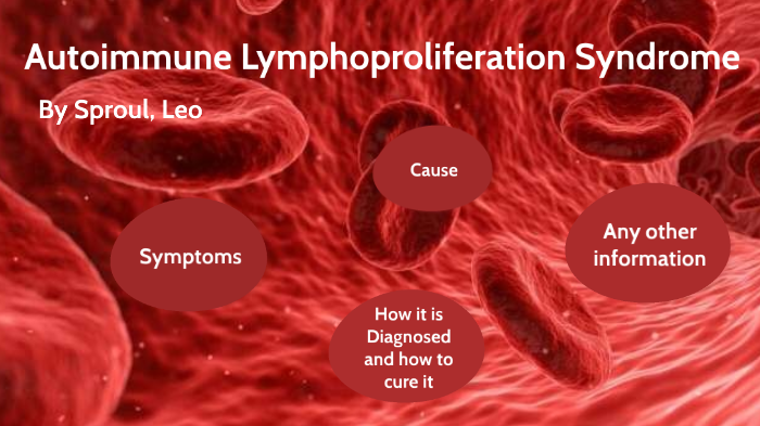 Autoimmune Lymphoproliferative Syndrome (ALPS) by Leo Sproul on Prezi