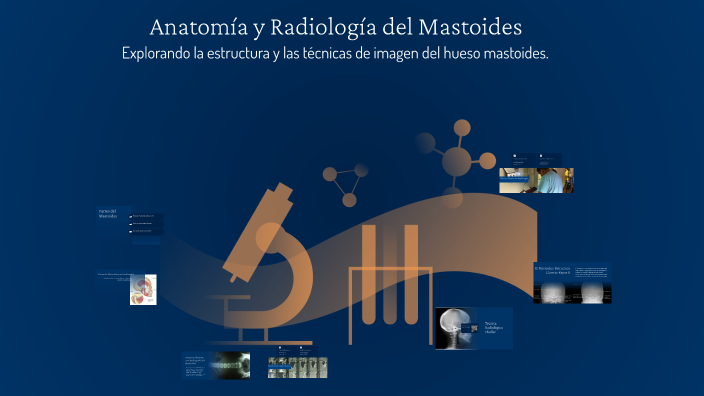 Anatomía y Radiología del Mastoides by MARLEN BOROR on Prezi